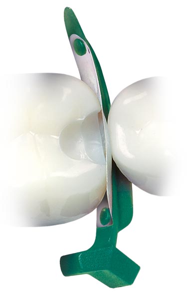 Directa FenderMate Kit - American Dental Accessories, Inc.