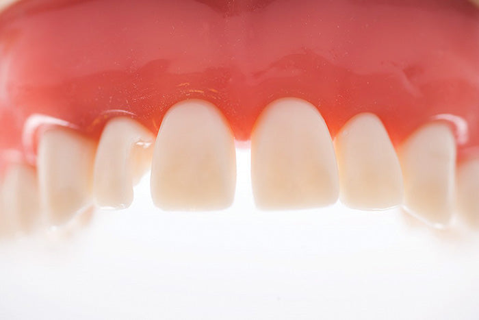 ProxyPal 3D Anterior Matrix Strips - American Dental Accessories, Inc.