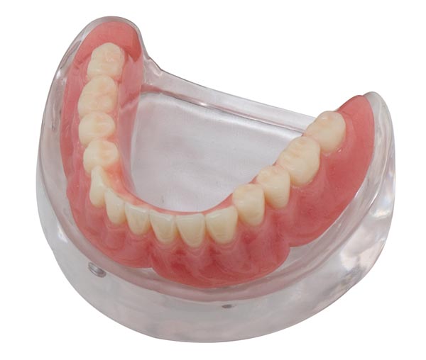 Locator Zest Denture Model - 2 Implants - American Dental Accessories, Inc.